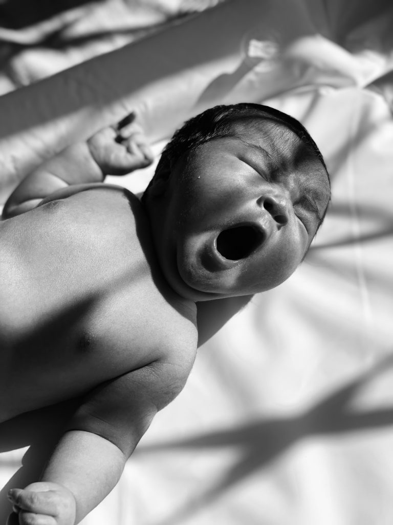 Lanugo Definition BirthForMen