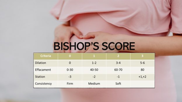 Bishop Score Definition – BirthForMen