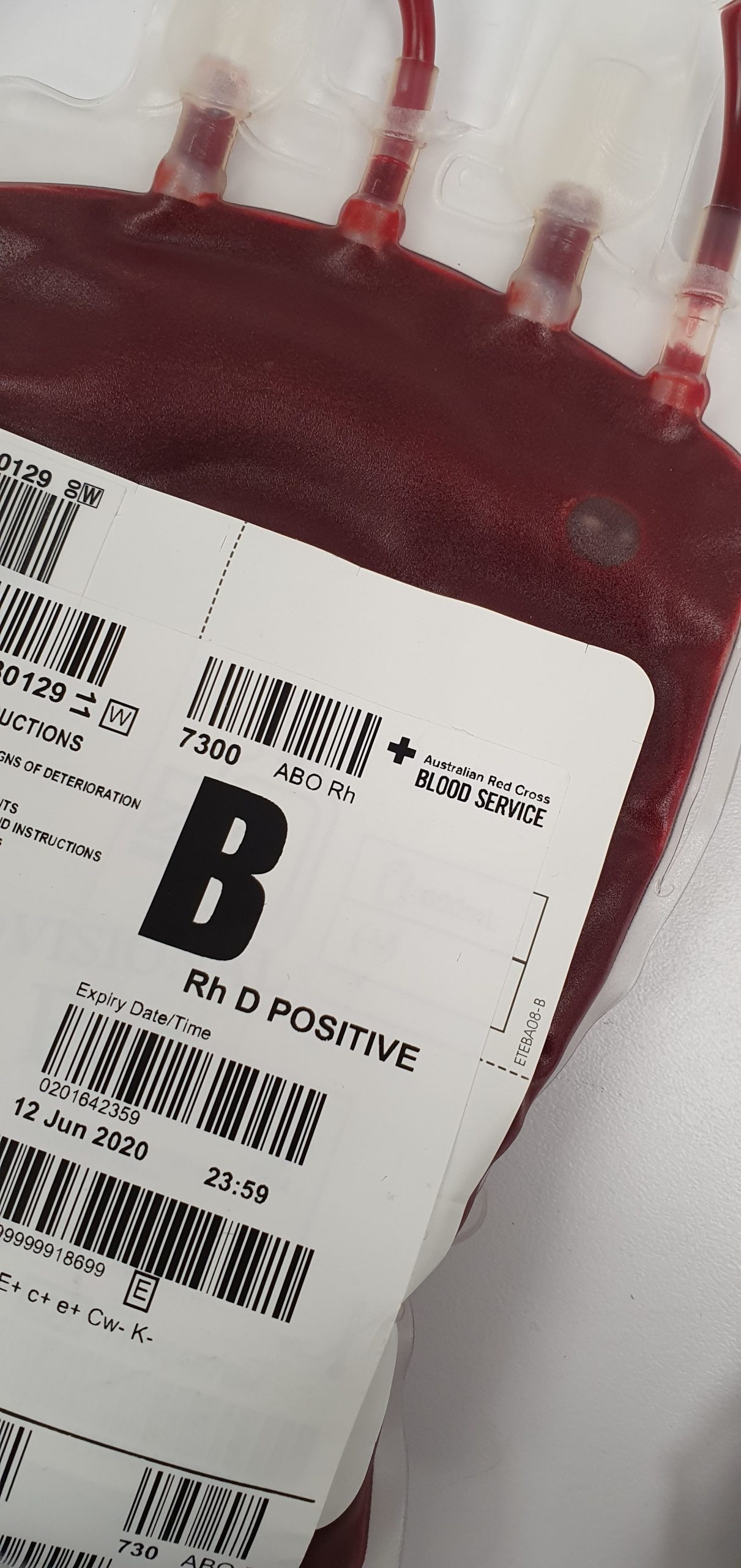 Autologous Transfusion Definition – BirthForMen